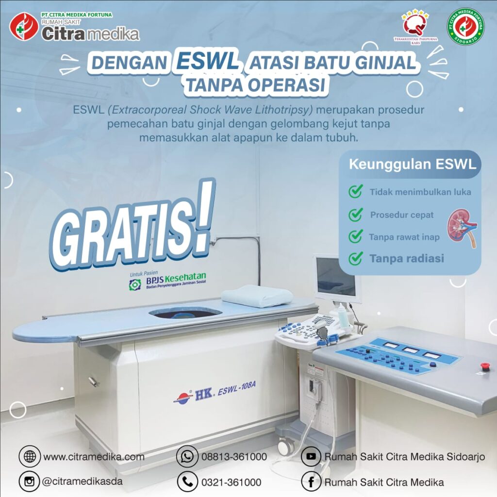 Dengan ESWL Atasi Batu Ginjal Tanpa Operasi – Rumah Sakit Citra Medika